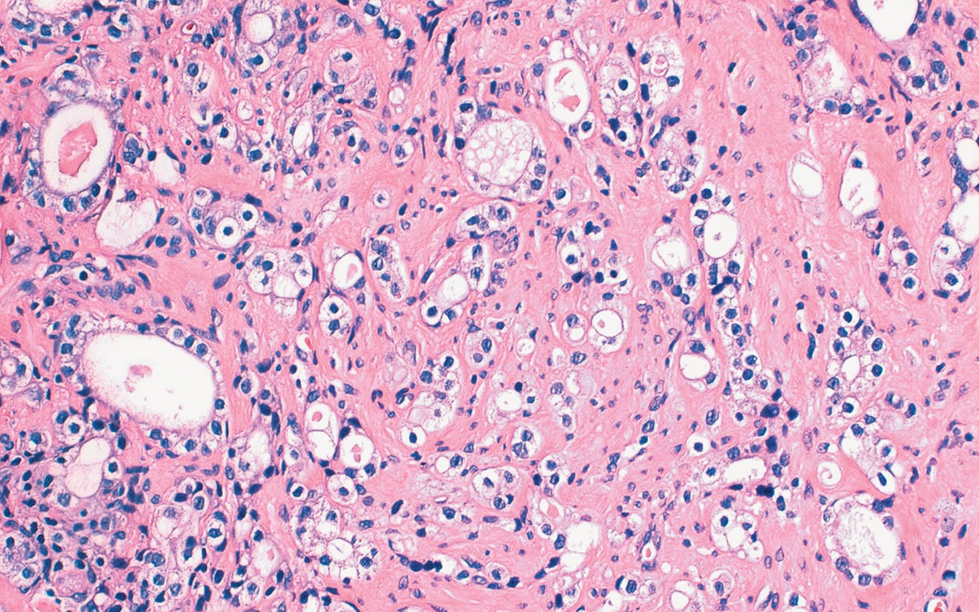 ASCP Patient Champions